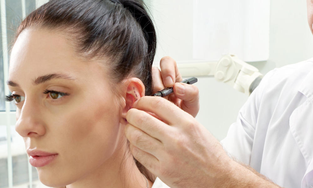The Art of Otoplasty for Prominent Ears